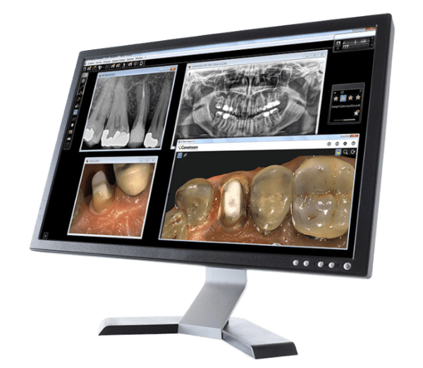 CS Imaging 8 - Optident
